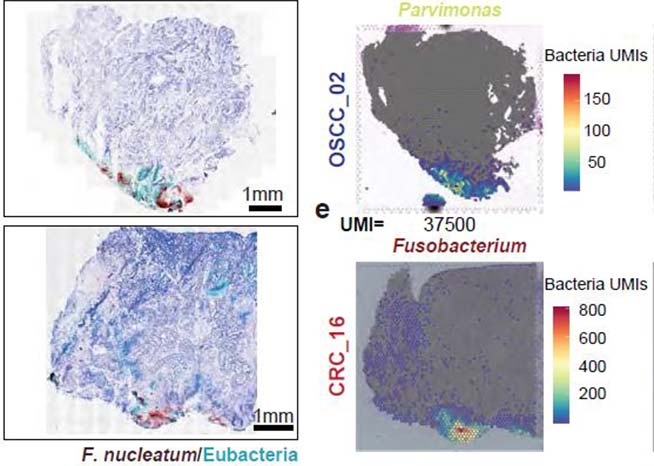 How bacteria give cancer a helping hand | Fred Hutchinson Cancer Center