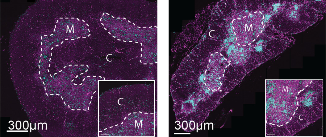 ‘Black hole’ formed by aging cells hobbles key immune organ’s function ...
