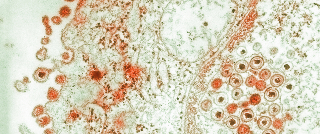 Engineered HSV can trigger genetic chain reaction, rejigger HSV genes ...