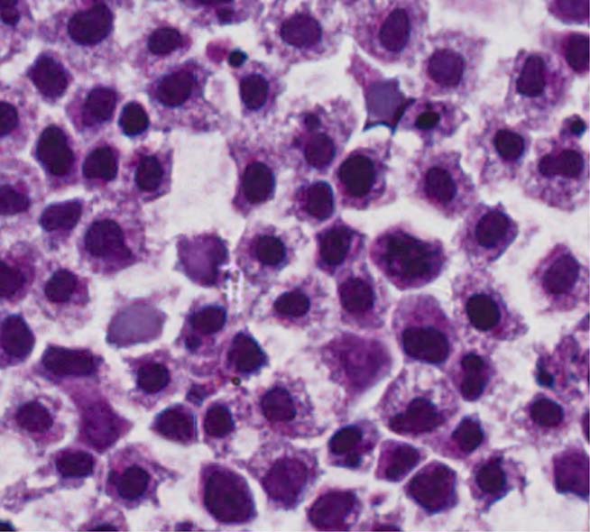 gene under microscope