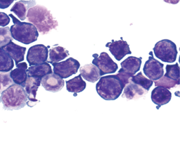 Sleeping Beauty awakens erythroleukemia drivers | Fred Hutchinson ...