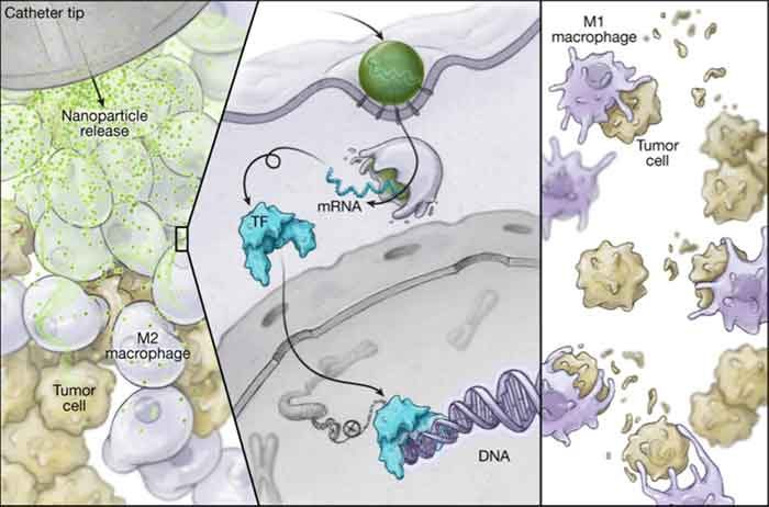 Reprograming macrophages with nanoparticles | Fred Hutchinson Cancer Center