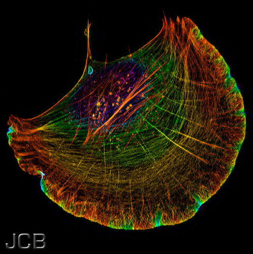 Cell migration: it’s no walk in the park | Fred Hutchinson Cancer Center