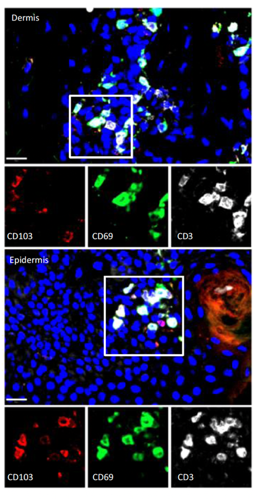 Cheers to long-lived memory T cells after shingles! | Fred Hutchinson ...