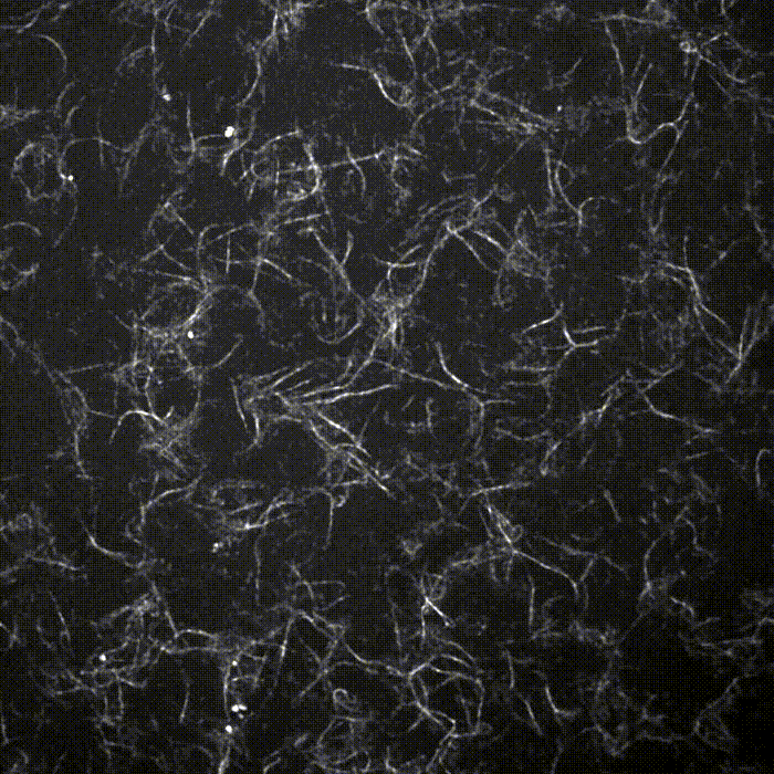 Spiraling inward to heal: a new mechanism for wound closure | Fred ...
