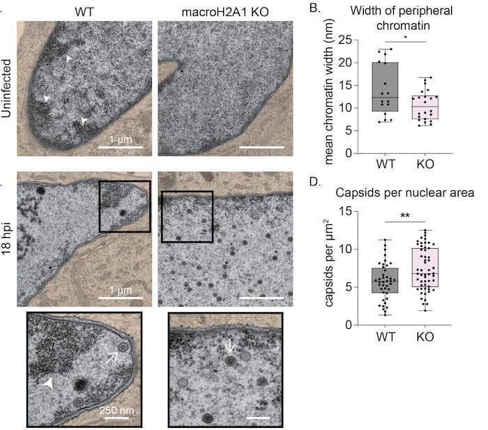 Exit or not? HSV-1 infection redistributes heterochromatin to exit the ...