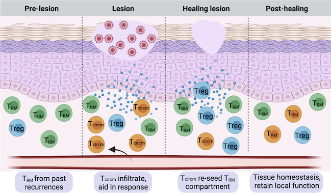 For T cells, HSV-2 infection is both a marathon and a sprint | Fred ...