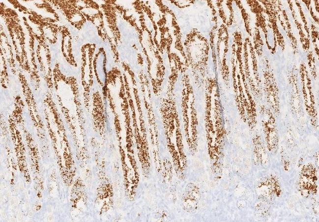 A new cell type with links to gastric cancer steps up for its mugshot ...