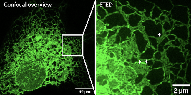 For Dr. Lena Schroeder, a (microscopic) picture is worth more than a ...