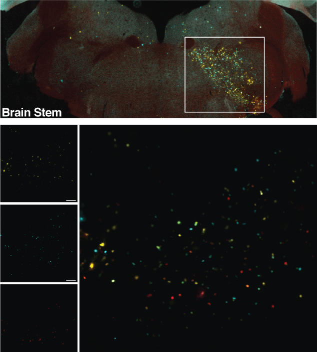 Driver’s ed: watching HSV co-infection and recombination in vivo | Fred ...