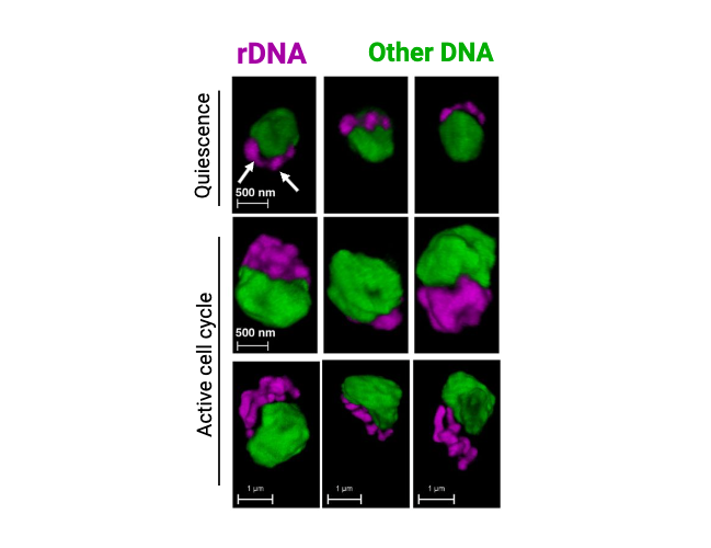 Sleepy cells rely on Sir2 to remodel their DNA landscape | Fred ...
