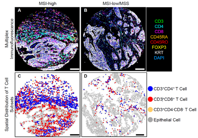 ‘Getting the T’ on T cell populations in colorectal cancer | Fred ...