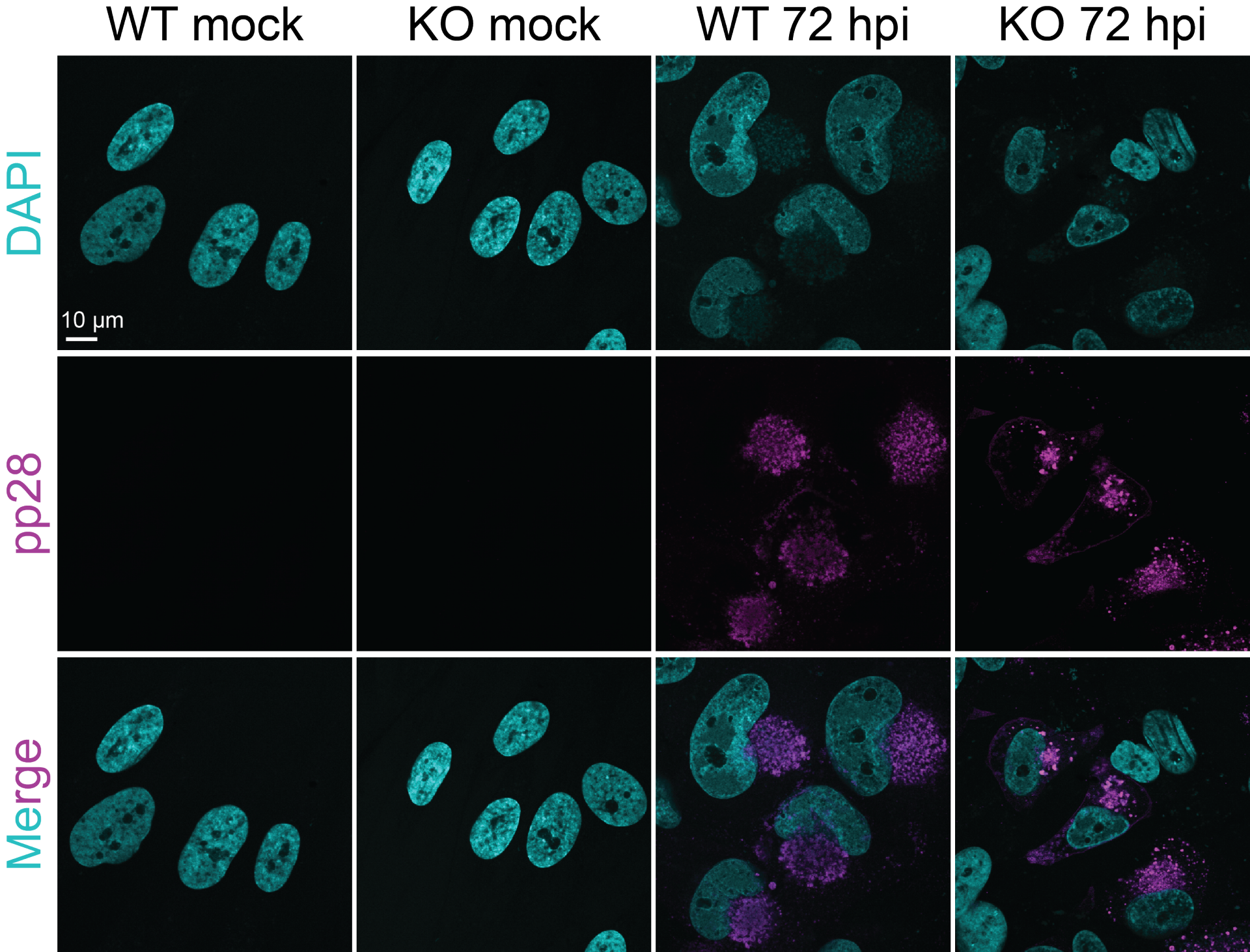 Brain trust: HCMV hijacks host chromatin to induce dormant neuronal ...