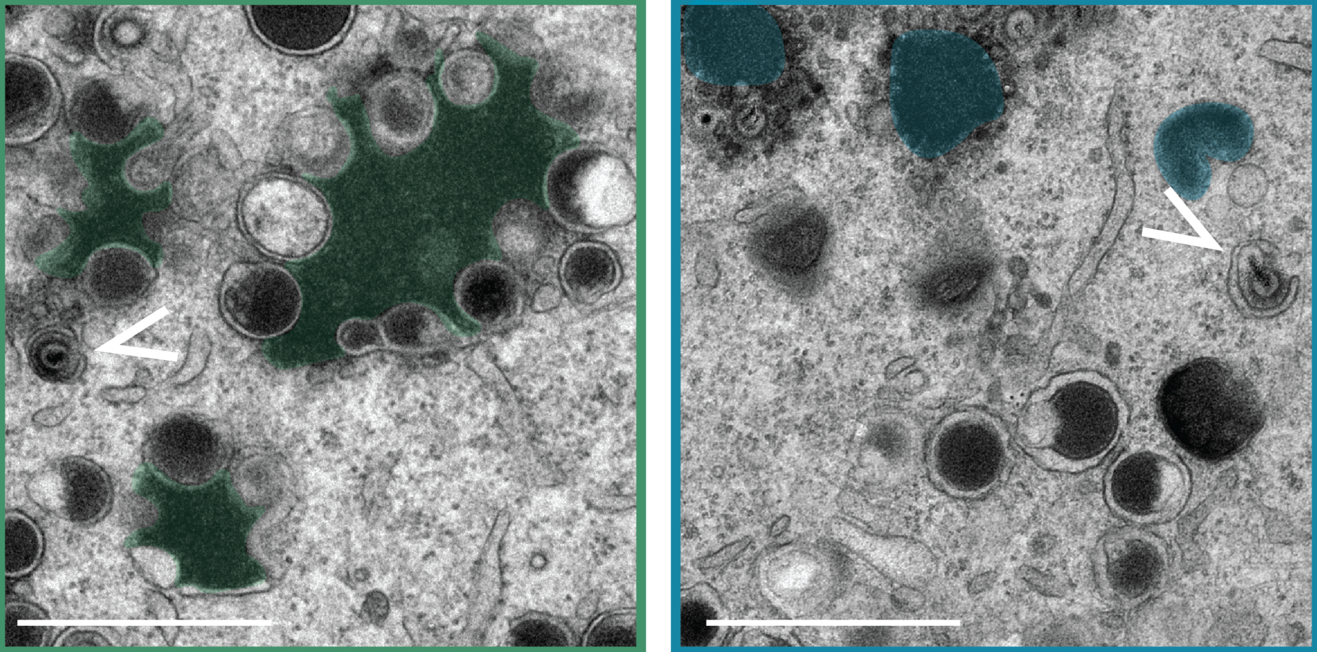 Brain trust: HCMV hijacks host chromatin to induce dormant neuronal ...