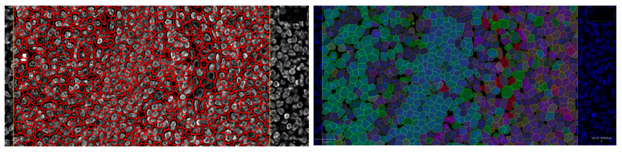 Translational Pathology | Fred Hutchinson Cancer Center