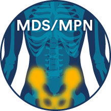 Disease Sites | Fred Hutchinson Cancer Center