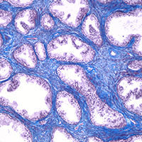 Stuart and Molly Sloan Precision Oncology Institute | Fred Hutchinson ...