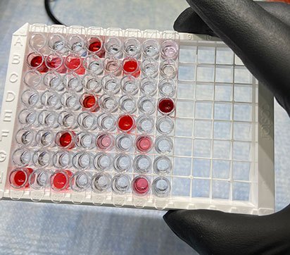 Biospecimen Processing and Biorepository: Services - Fred Hutch