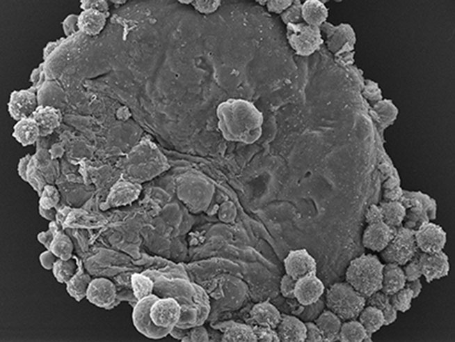 electron microscope sem tem