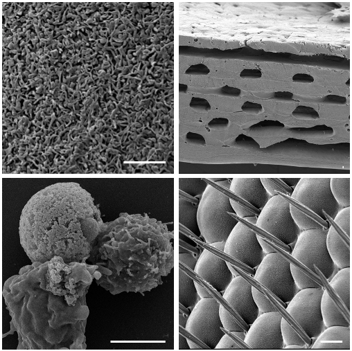 Sem And Tem Microscopes