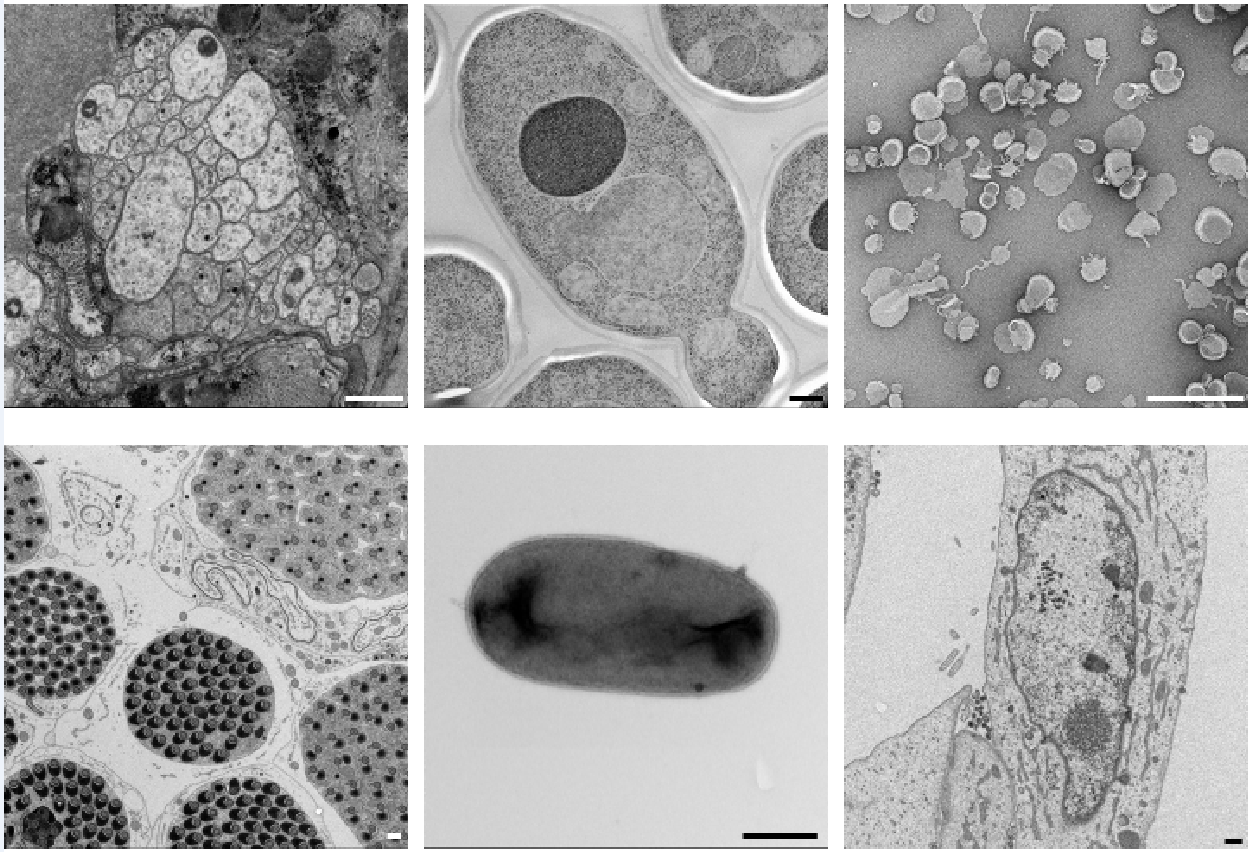 Electron Microscopy: TEM and SEM Services | Fred Hutchinson Cancer Center