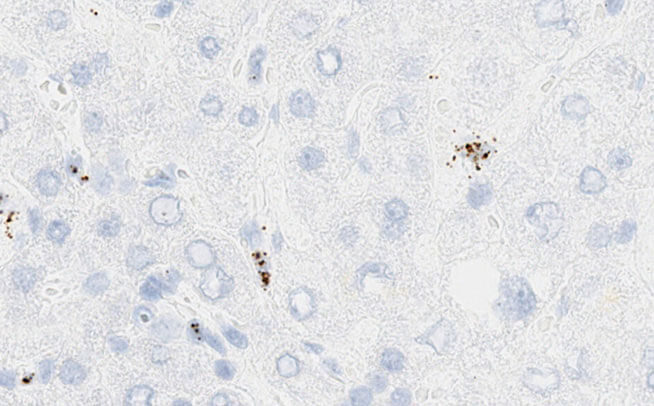 Experimental Histopathology: IHC/ISH/Multiplex Services - Fred Hutch