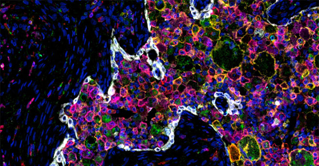 Experimental Histopathology: IHC/ISH/Multiplex Services | Fred ...