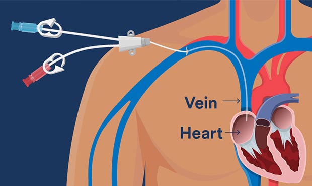 Our Breakthroughs | Fred Hutchinson Cancer Center